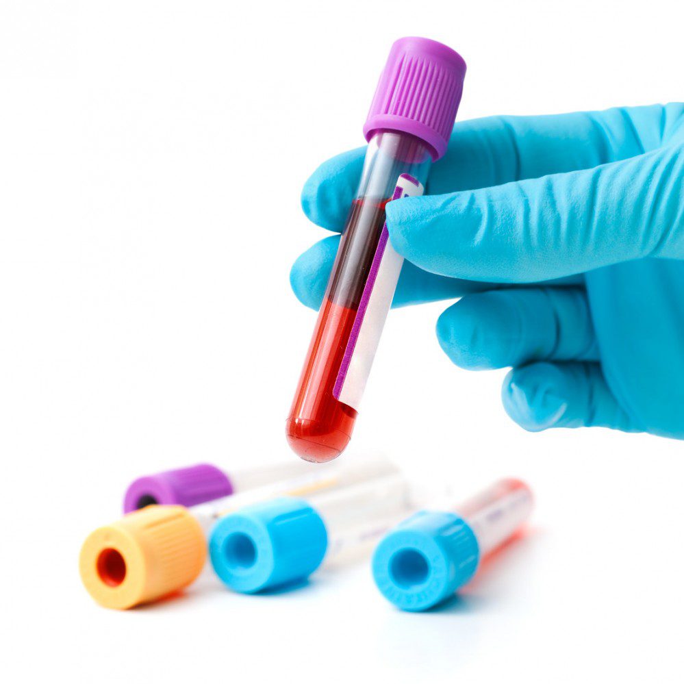 Female Hormone Tests - DUTCH test - Hormone Blood Testing